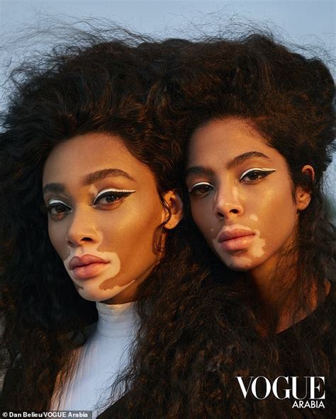 Winnie Harlow Covers Vogue Arabia With Another Model Who Has Vitiligo