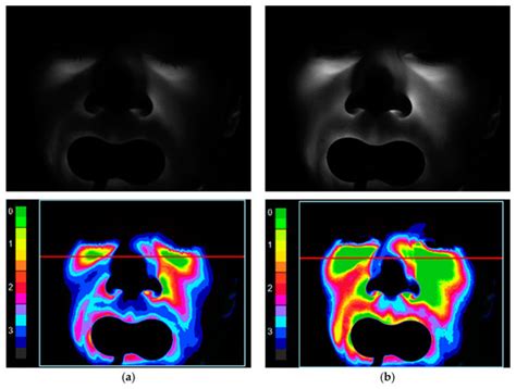 Diagnostics Special Issue Optical Diagnostics In Human Diseases