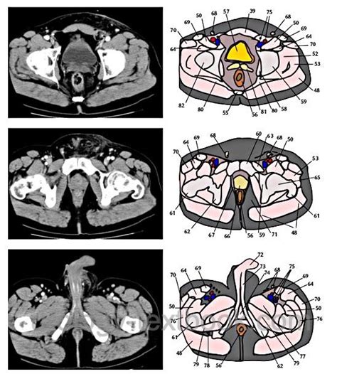 Computed Tomography Ct Scan Technique And Sectional Anatomy