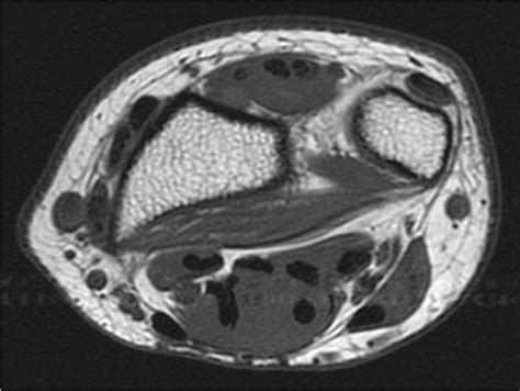 Wrist Radiology Diagram Quizlet