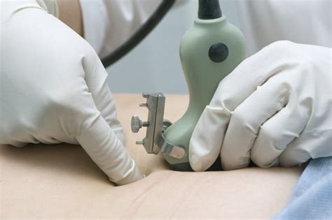 Cordocentesis The American Pregnancy Association