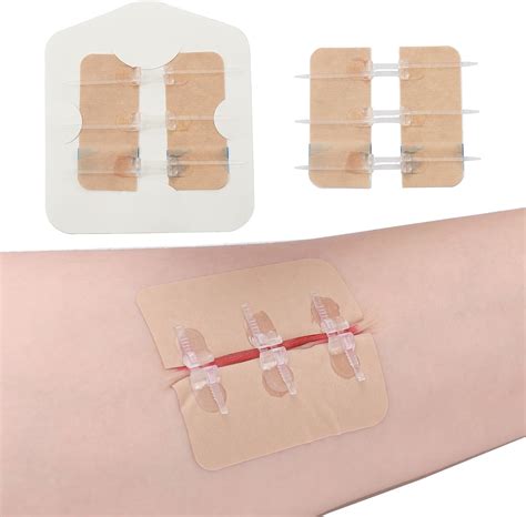 Bandage On Stitches At Walter Mcglothlin Blog