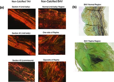 Representative Layer Arrangement From Histology Shows Organized And Download Scientific Diagram