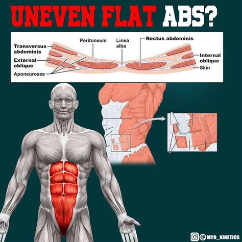 Uneven Abs