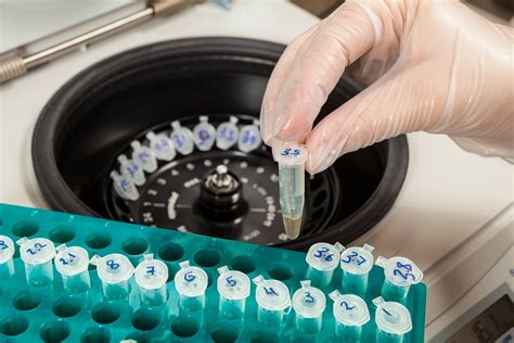Purification Tagged Plasmid Isolation Dmark