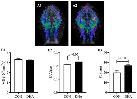Diffusion Tensor Imaging Analysis Representative Whole Brain