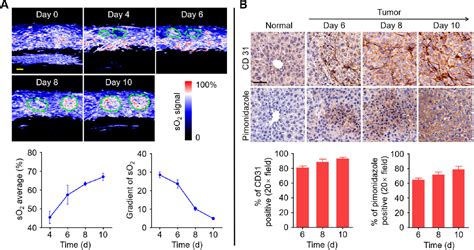 Figure 5 From Label Free Visualization Of Early Cancer Hepatic Micrometastasis And