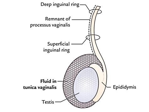 Easy Notes On 【testis And Epididymis】learn In Just 3 Minutes
