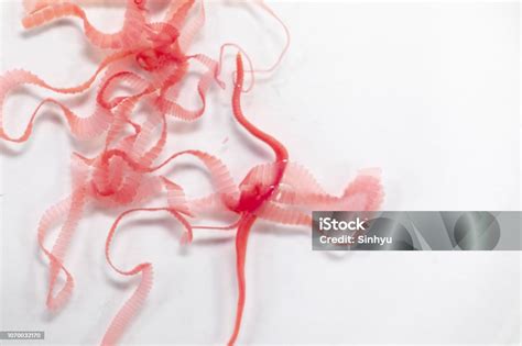 Tapeworm Under A Microscope