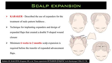 Tissue Expander In Omfs Pdf