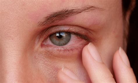 Eye Injections For Long Beach Ca Apex Retina Institute Ophthalmologist And Retina And