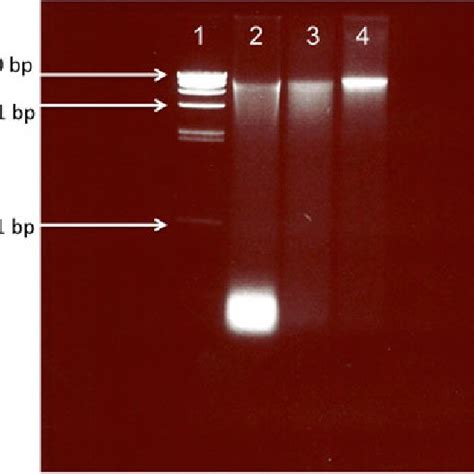 Pdf Dna Extraction Protocols For Whole Genome Sequencing In Marine Organisms