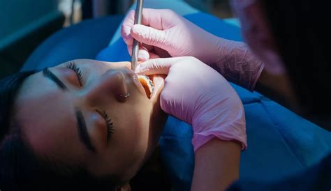 Bube Pe Limbă Cauze Factori De Risc şi Metode Eficiente De Tratament