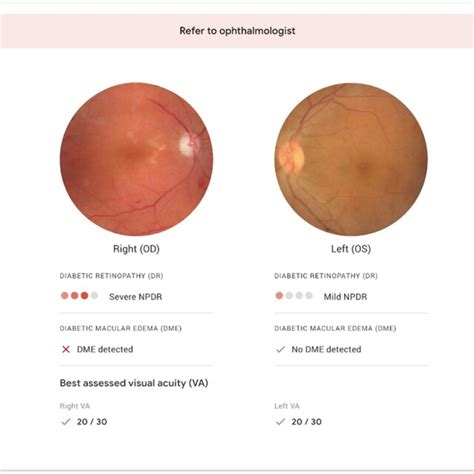 Web Application Displaying The Deep Learning Models Predictions For Download Scientific