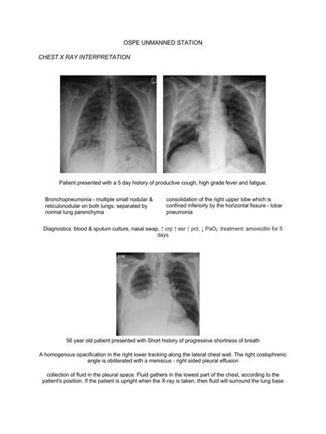 Ospe Unmanned Station Chest X Ray Pdf Lung Pneumonia