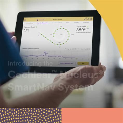 Video Cochlear On Linkedin Introducing The Cochlear™ Nucleus