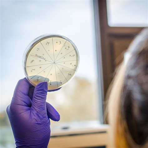 Microbiología Diagnóstica Moreno Laboratorio De Análisis Clínicos