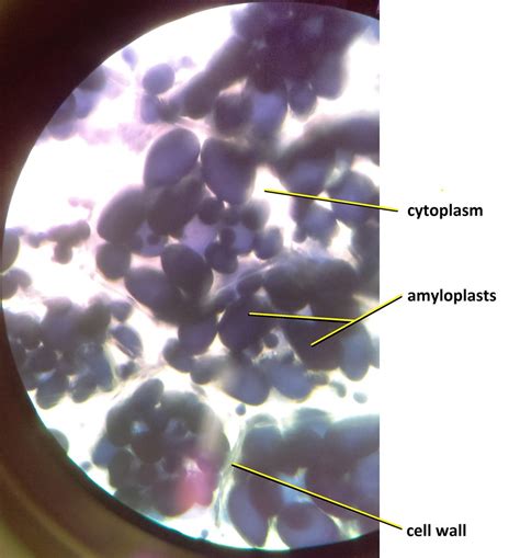 Amyloplasts 400xa Oval Amyloplasts In Potato Cross Section Flickr