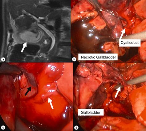 Pancreatico Biliary Emergencies Clinical Tree