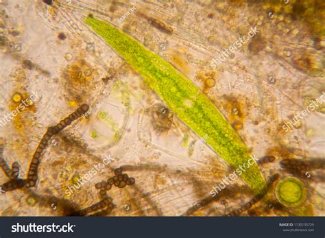Fresh Pond Water Plankton Algae Microscope Foto De Stock 1130135729