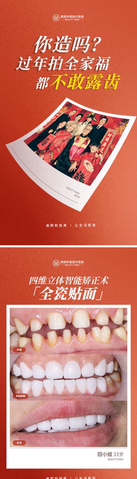 口腔矫牙案例征集海报psd广告设计素材海报模板免费下载 享设计