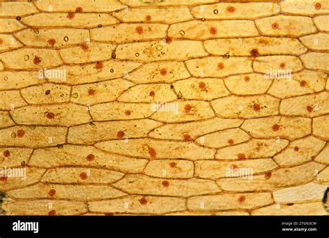 Onion Cell Under Microscope Nuclear Membrane