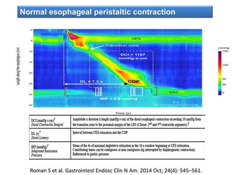 Chicago Classification Version 40 Hrm Classification Of Esophageal