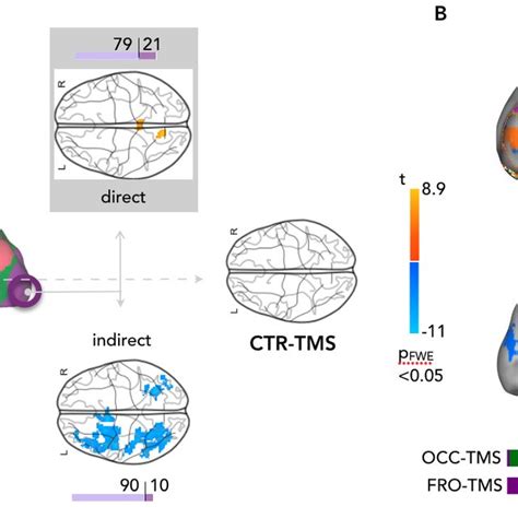 Opposite Effect Of Tms On Brain Functional Connectivity A Download Scientific Diagram