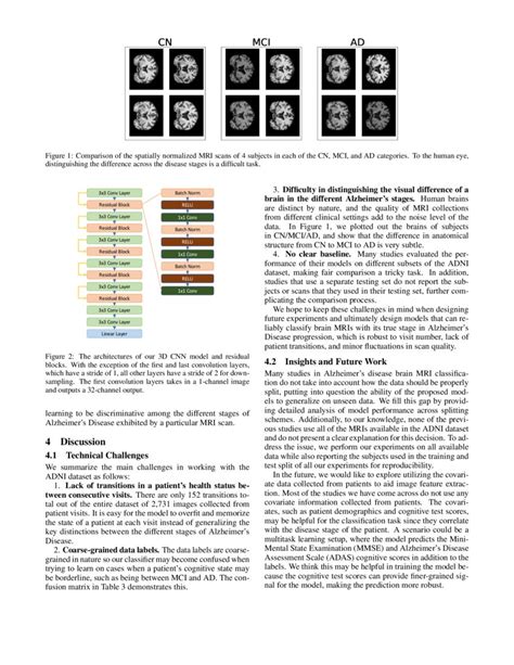 Alzheimers Disease Brain Mri Classification Challenges And Insights