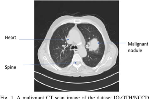 Figure 1 From Implementation Of Different U Net Architectures For