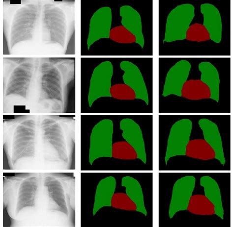 semantic segmentation on the jsrt dataset red color represents the