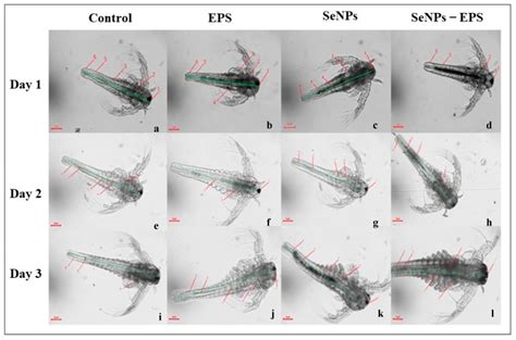 Synthesis And Structural Characterization Of Selenium Nanoparticles