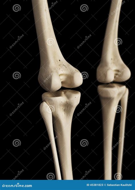 List 93 Pictures Knee Cap Knee Bone Spur Pictures Superb