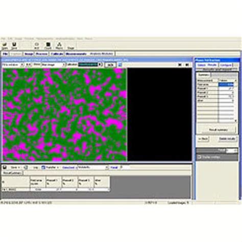 Image Analysis Software At Best Price In Hyderabad By Medimagetechnologies Private Limited Id