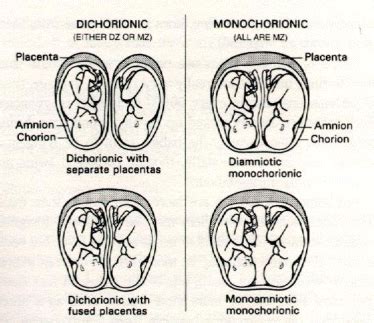 P A R E N T I N G M U L T I P L E S G U I D E