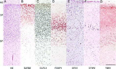 Layer Specific Marker Expression Of The Neocortex At 23 Gws Around 20