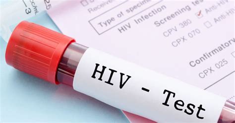 Hiv Index Testing Is Of Concern To Advocates Young Queer Alliance
