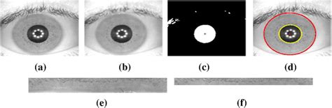 Illustration Of Iris Pre Processing A Original Image B Image After Download Scientific
