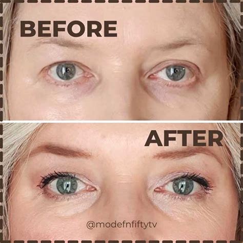 Makeup Tips For Droopy Eyelids Mugeek Vidalondon