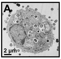 Group B Streptococcus Turns Defense Into Offense During Pregnancy Infections Research