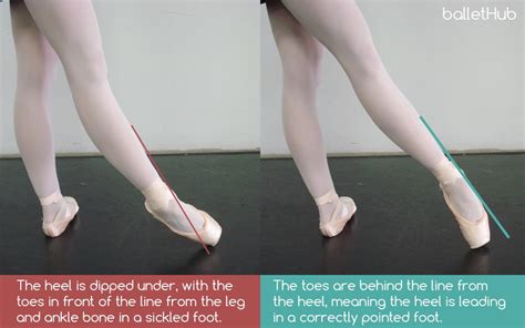 Sickling In Ballet What Why And How To Avoid It To The Front Beginner Ballet Ballet