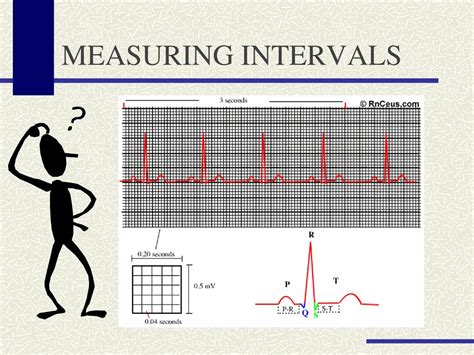 Rhythm Strip Interpretation