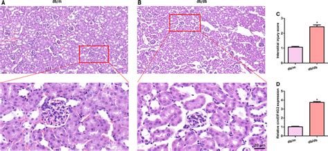 increased renal fibrosis and downregulation of circeif4g2 in db db mice download scientific