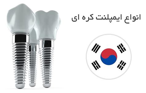 معرفی 7 برند ایمپلنت کره ای در ایران