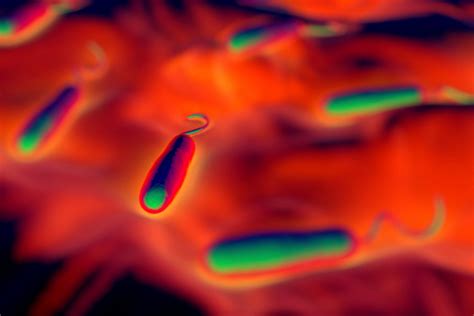 Free Picture Vibrio Cholerae Bacteria Electron Micrograph