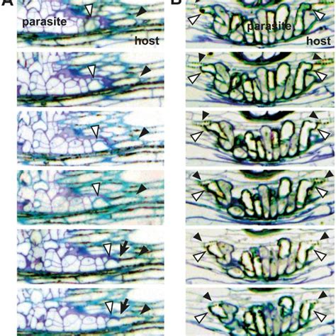 Interaction Of Parasite Tes With Host Xylem At The Interface A Download Scientific Diagram