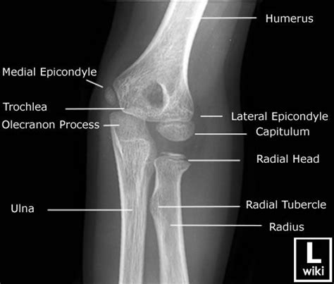Pediatric Elbow Anatomy Artofit