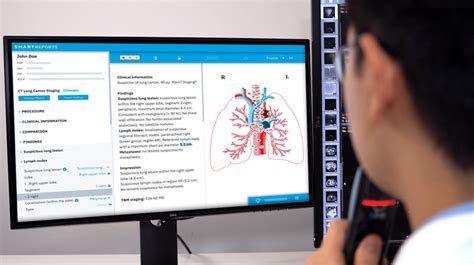 Munich Based Smart Reporting Secures €15 Million Investment To Enhance Medical Documentation