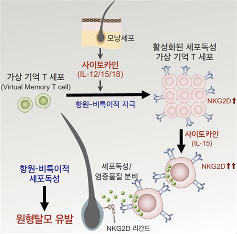 내 머릿속 골칫거리 ‘원형탈모 원인 알고 보니 서울신문 내 머릿속 골칫거리 ‘원형탈모 원인 알고 보니 서울신문