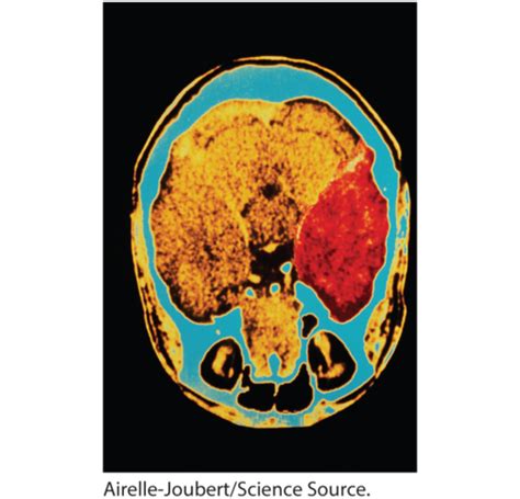 Psych Ch 6 Memory Flashcards Quizlet